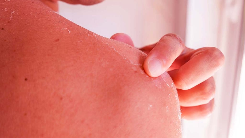 Reverse Sun Damage: Red Light Therapy for Skin Rejuvenation