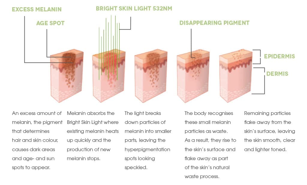 Bright Skin Light Brightens In The Long Term
